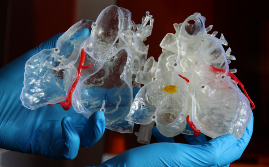 Here's how 3D printing is revolutionising healthcare